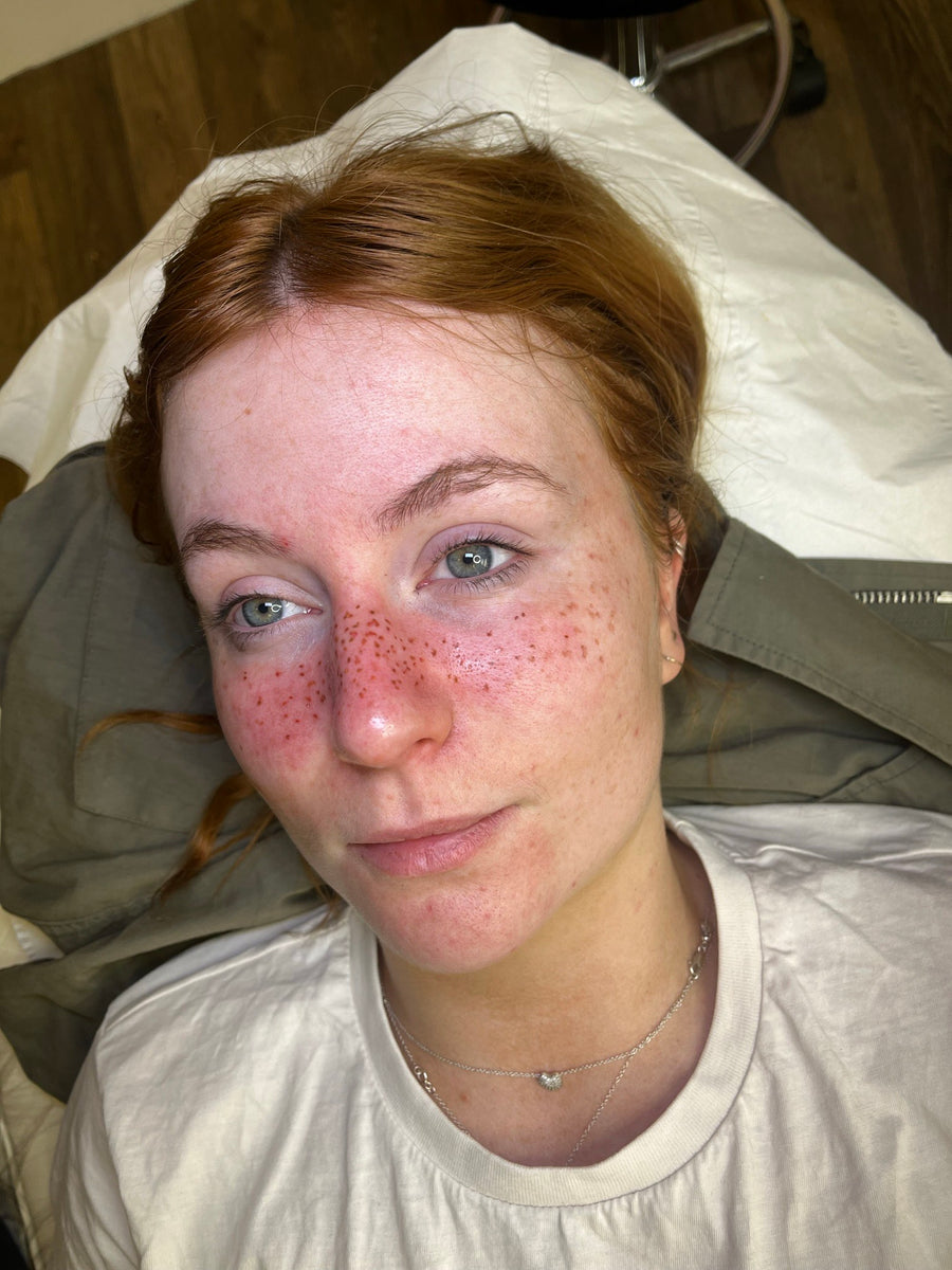 The ultimate guide to freckle tattoos – Stories and Ink